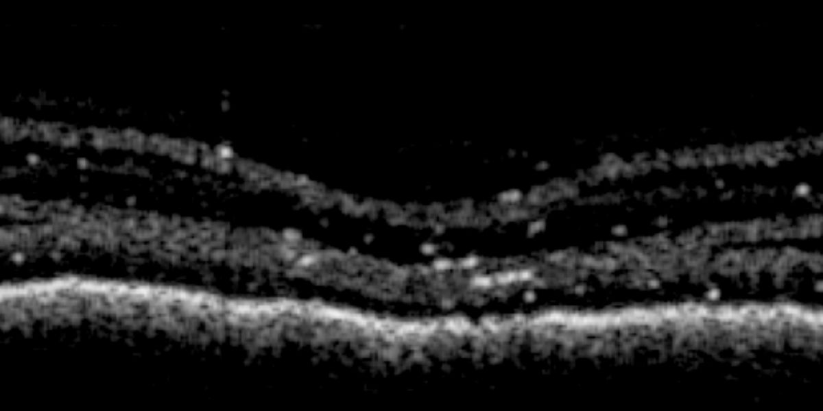 Bristol startup achieves breakthrough in eye scanning technology ...