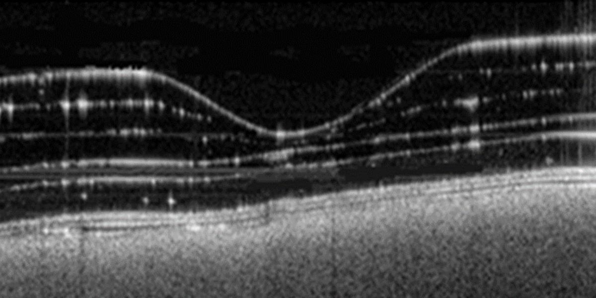 Bristol startup achieves breakthrough in eye scanning technology ...